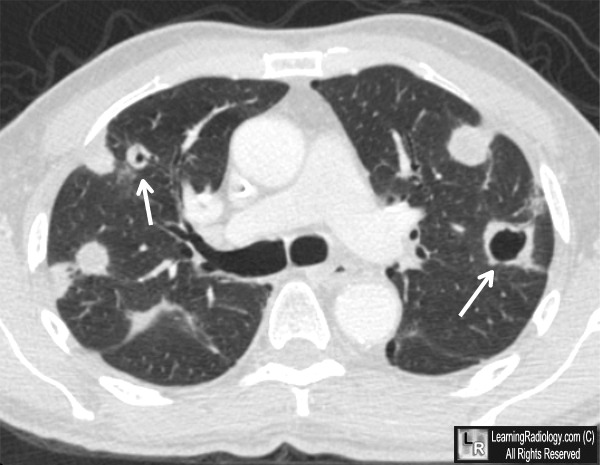 Learningradiology
